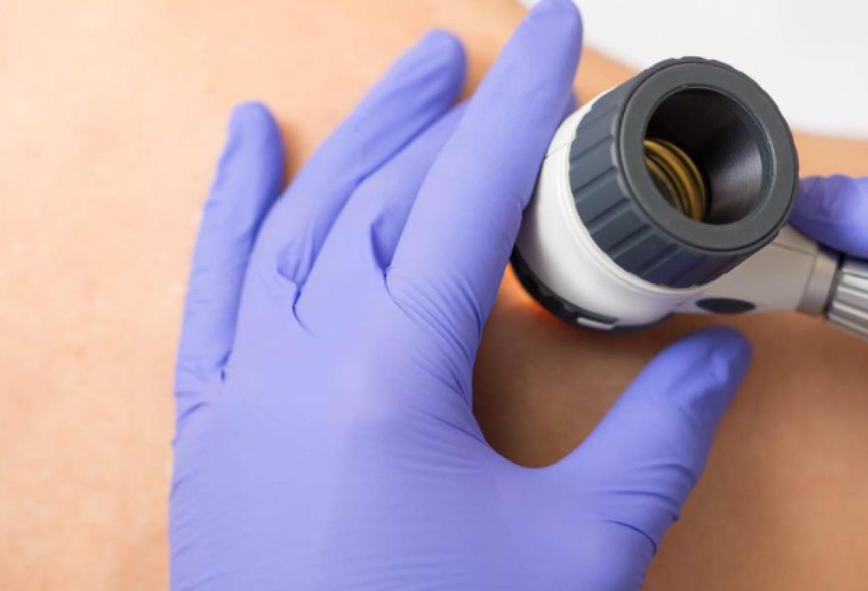 Tratamientos láser para tu piel | Inederm